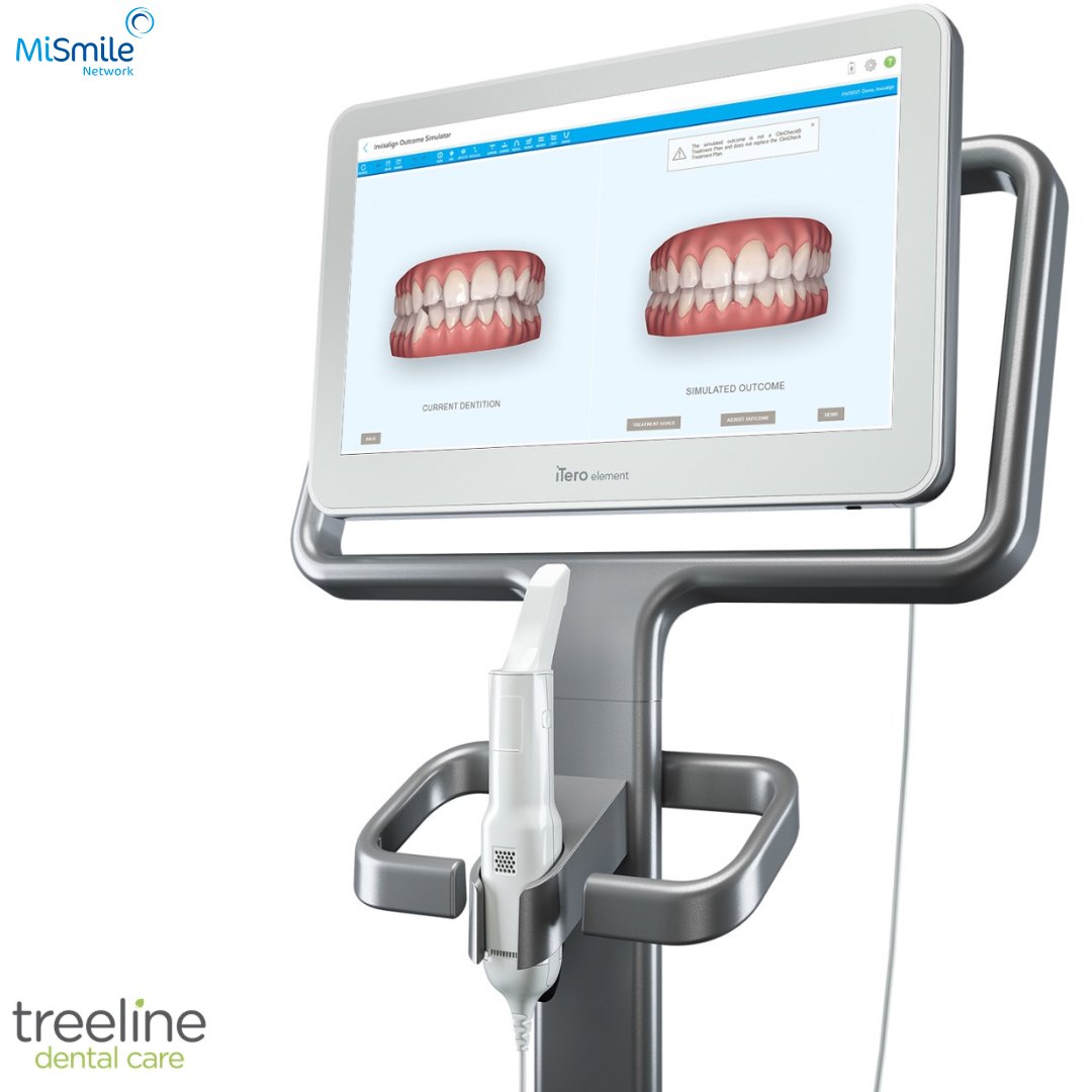 What is MiSmile? - Treeline Dental Care